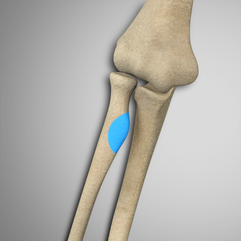 Lección 3: Bíceps braquial – inserciones y acciones – Club Pilates ...